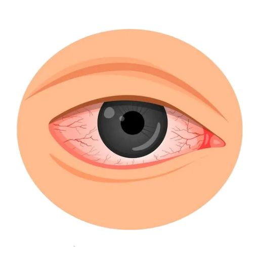 Can Sleeping With Contact Lenses Make You Blind